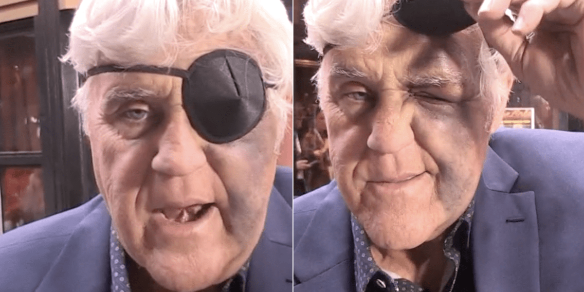 Jay Leno's Bruised Face, Eyepatch Lead to 'Gambling Shark...